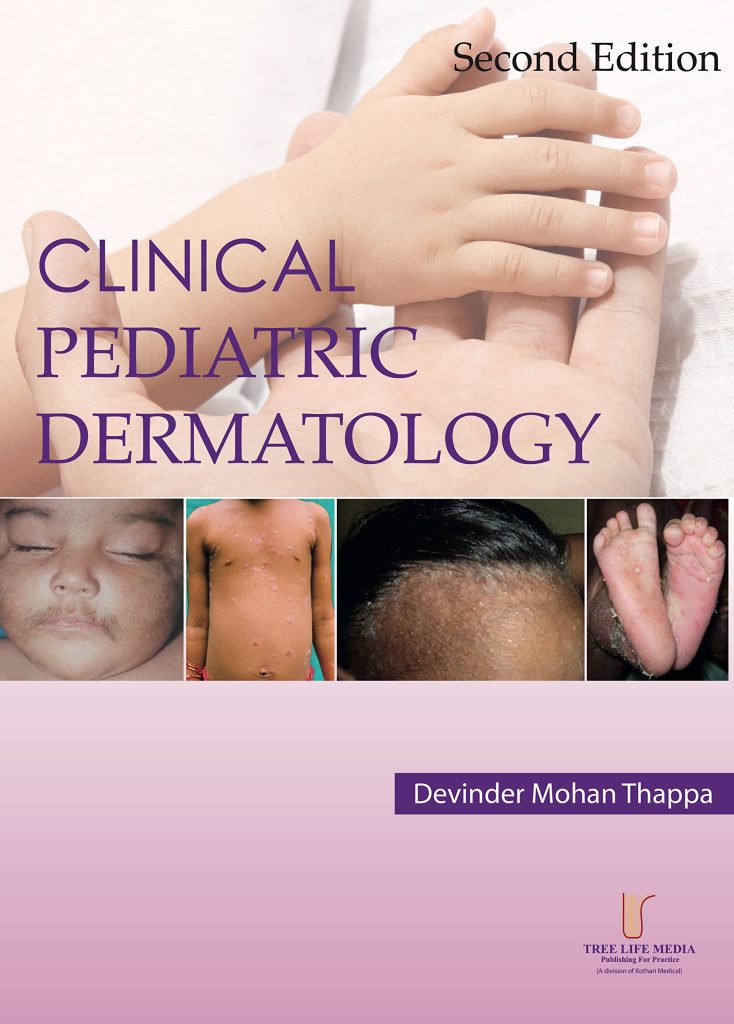 Clinical Pediatric Dermatology – Kothari